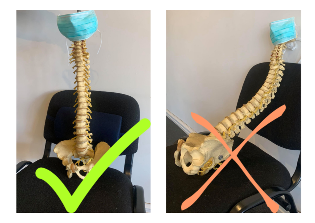 Poor Posture - Ormond Physiotherapy